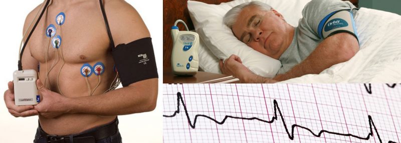 ᐈ Holter Cardíaco a Domicilio en Capital Federal, zona Norte, Sur y Oeste